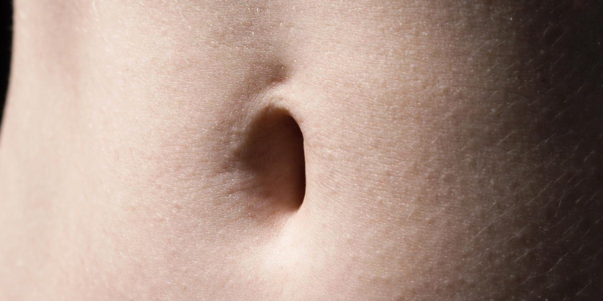 Onderzoek Erasmus MC: ‘Matjes beter bij kleine navelbreuken dan hechten ...