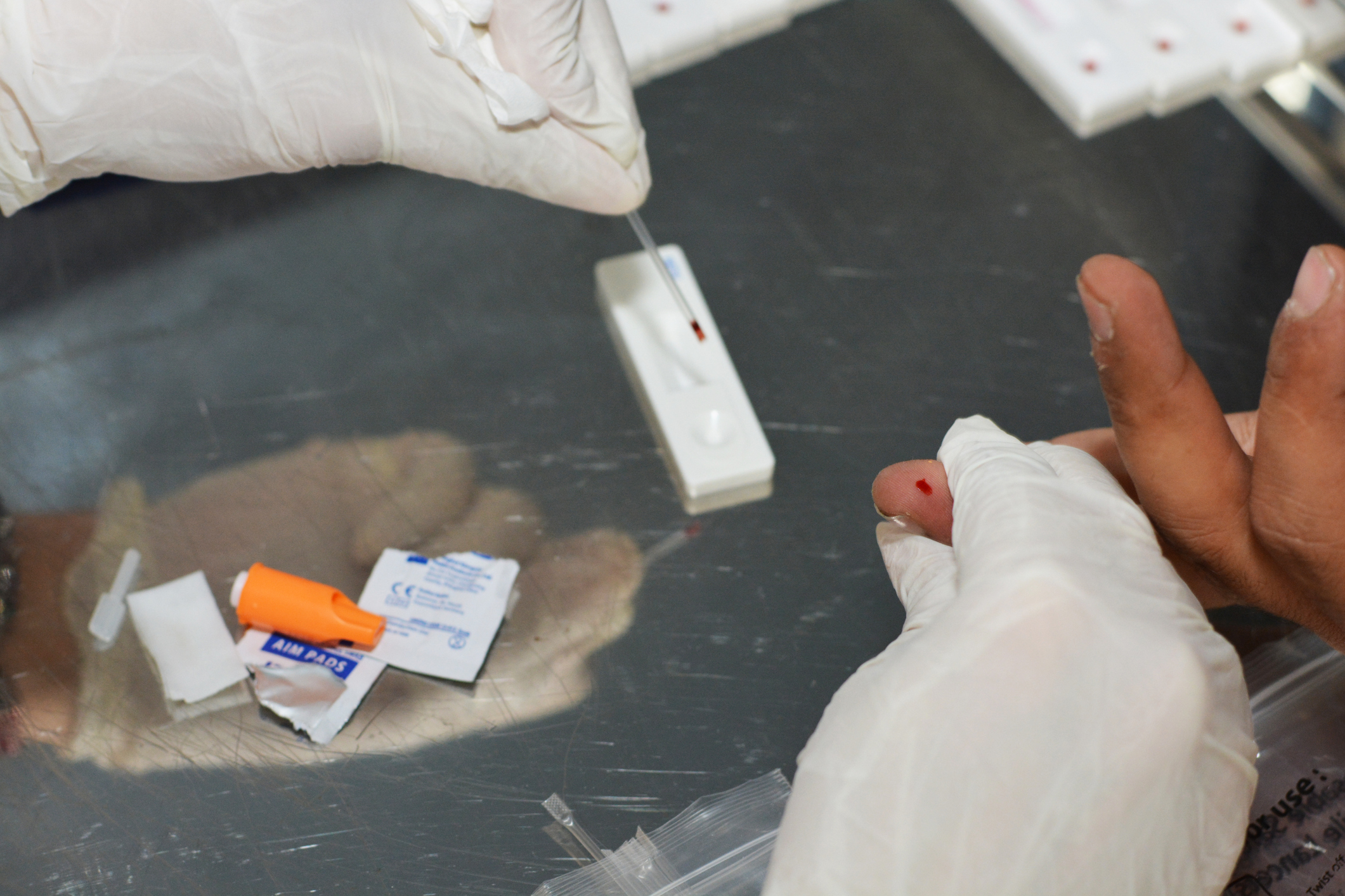 Betere controle van HIV-behandeling met beperkte middelen - Dr ...